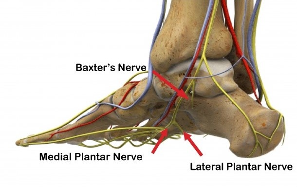 7 Questions Guide Relief From Plantar Fasciitis Pain